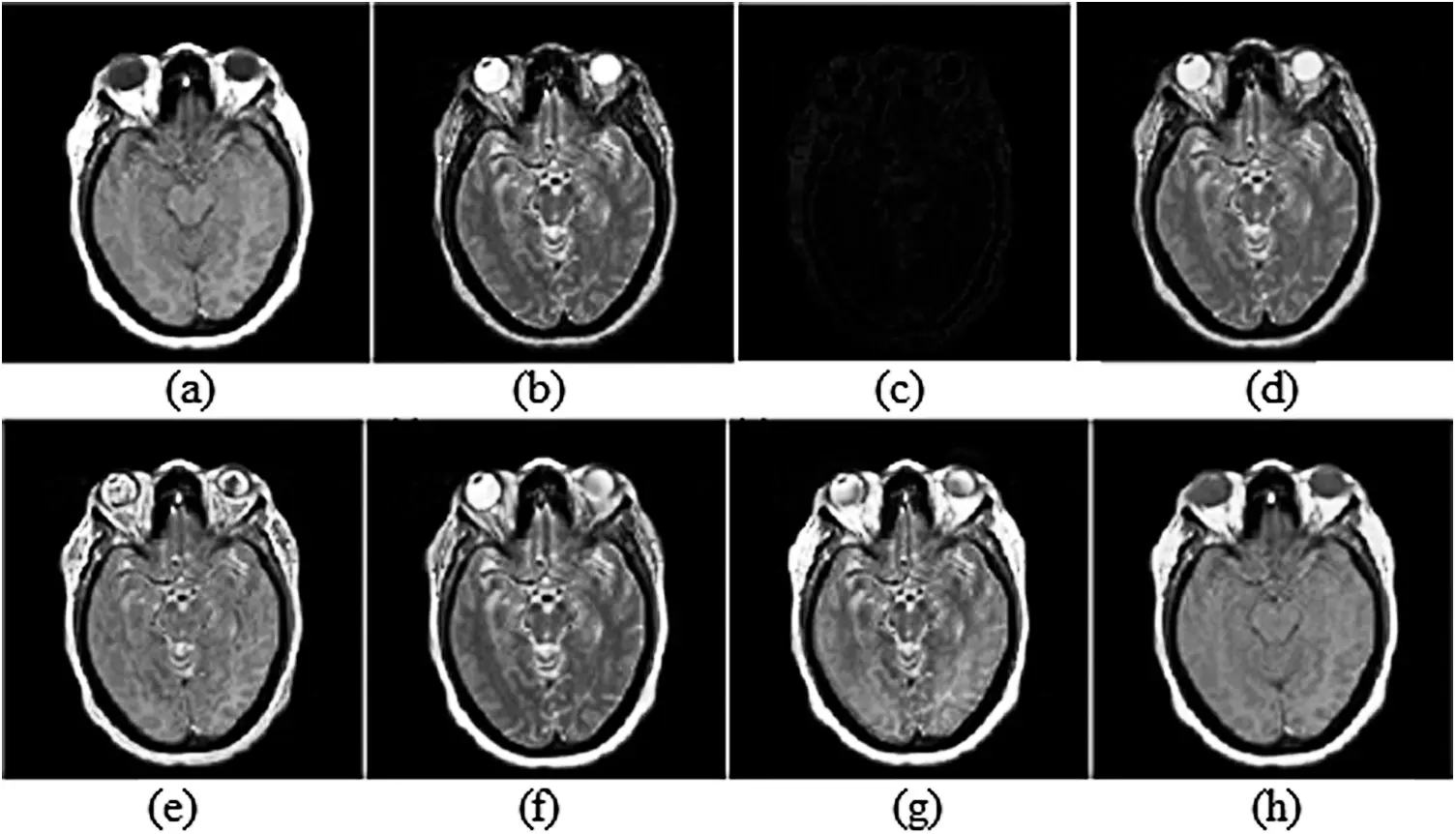Multimodal Medical Image Registration and Fusion for Quality Enhancement