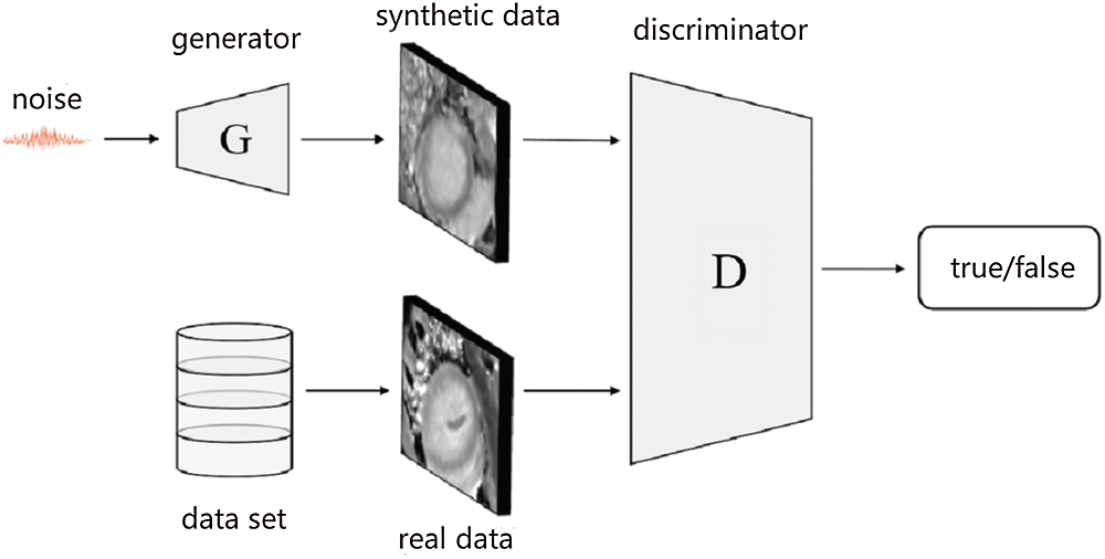 Evolutionary GAN–Based Data Augmentation for Cardiac Magnetic Resonance ...