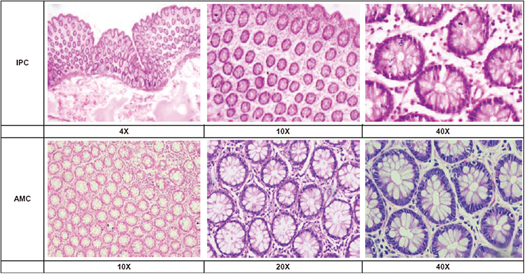 Robust Magnification Independent Colon Biopsy Grading System over ...