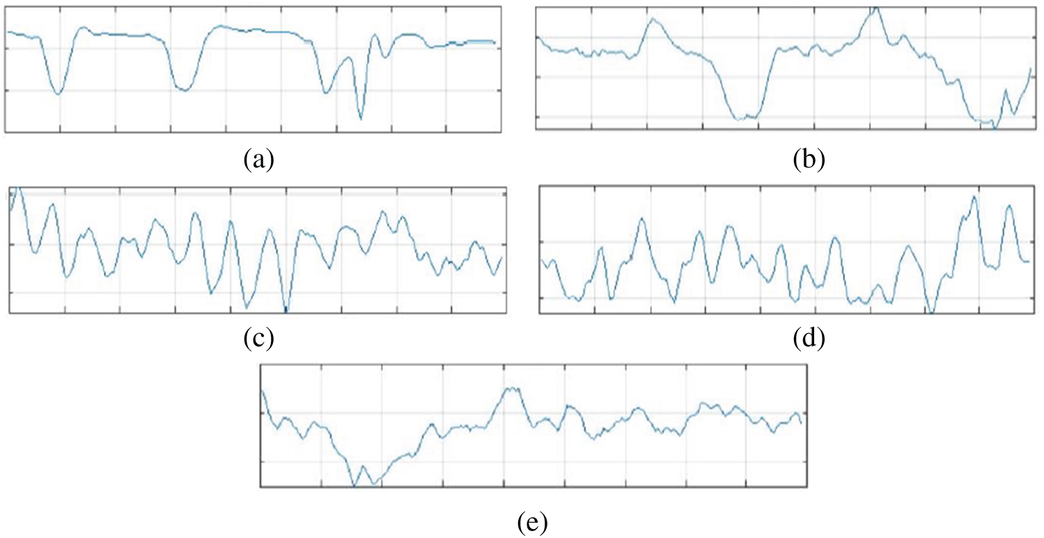 Integrated CWT-CNN for Epilepsy Detection Using Multiclass EEG Dataset