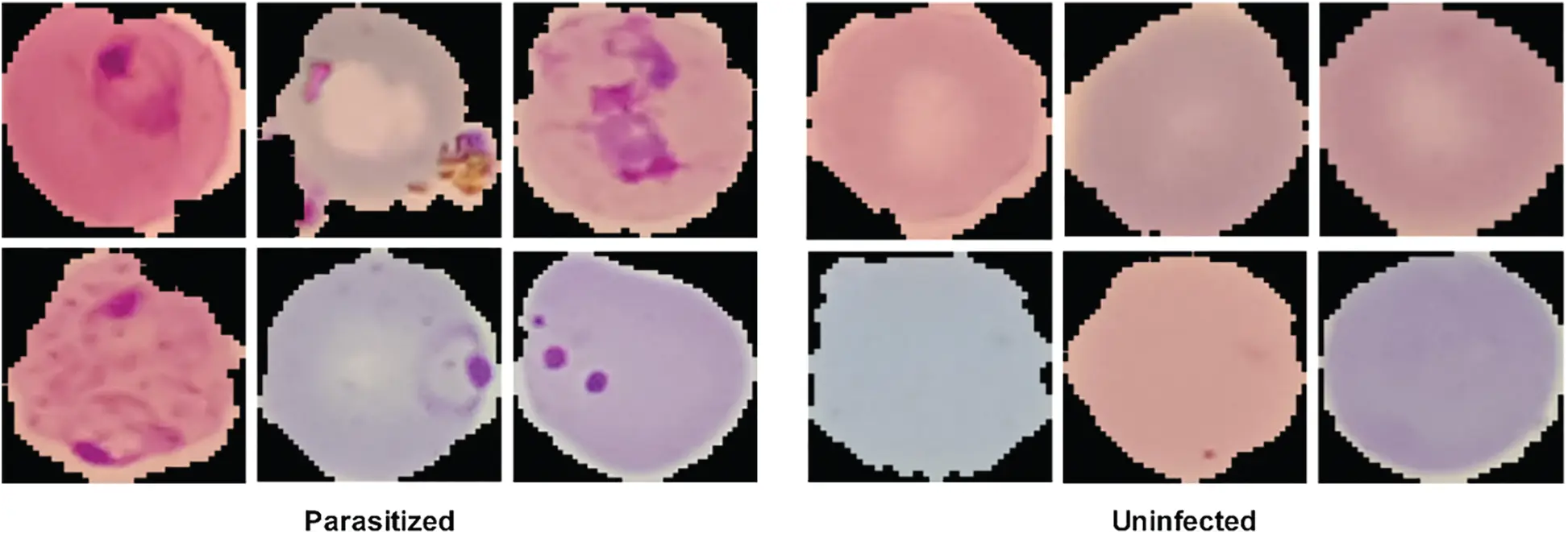 Malaria Blood Smear Classification Using Deep Learning and Best ...