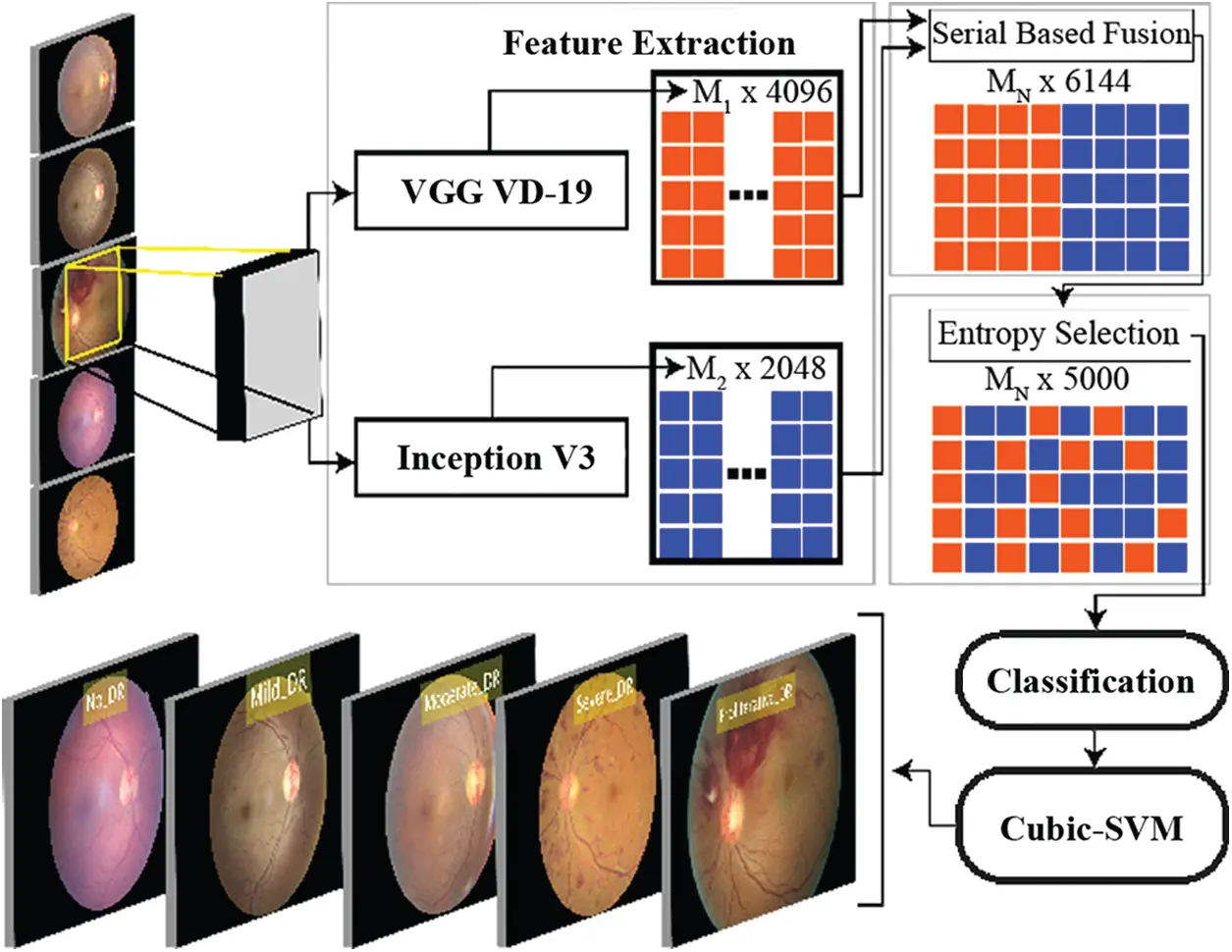 A Multilevel Deep Feature Selection Framework for Diabetic Retinopathy Image Classification