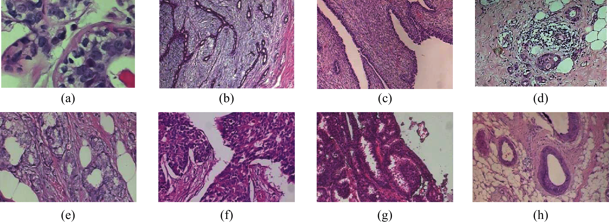 ResNet50-Based Effective Model for Breast Cancer Classification Using ...