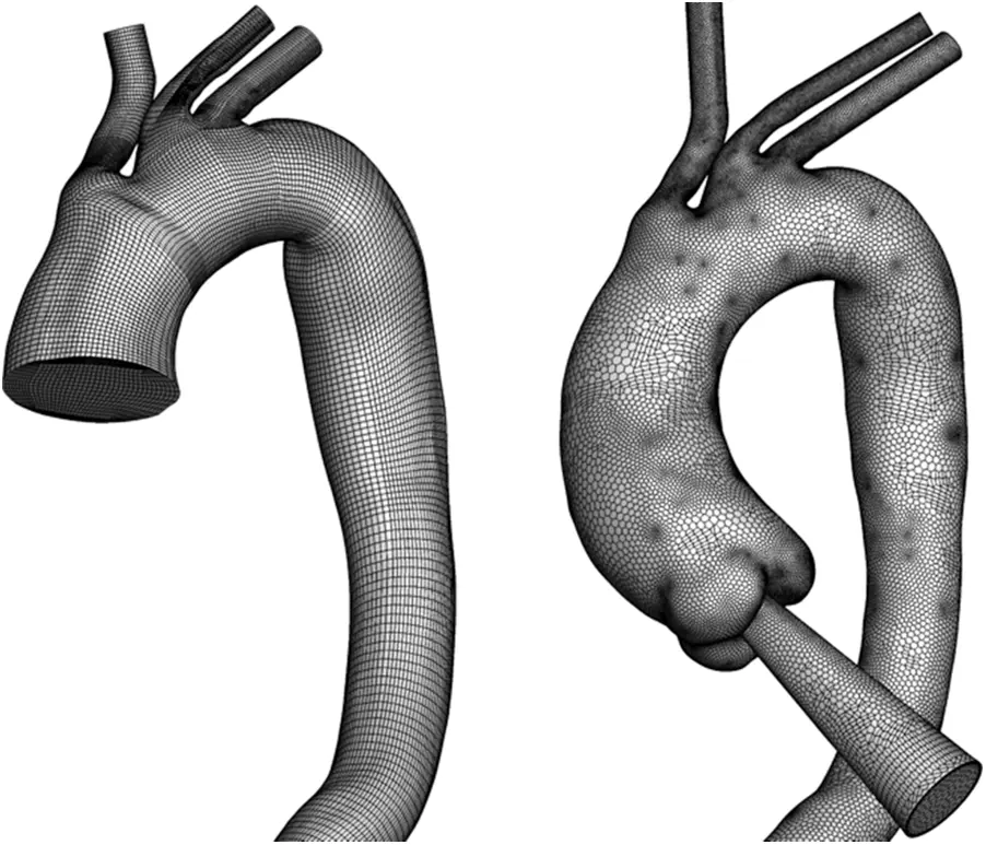 Study of Effect of Boundary Conditions on Patient-Specific Aortic ...