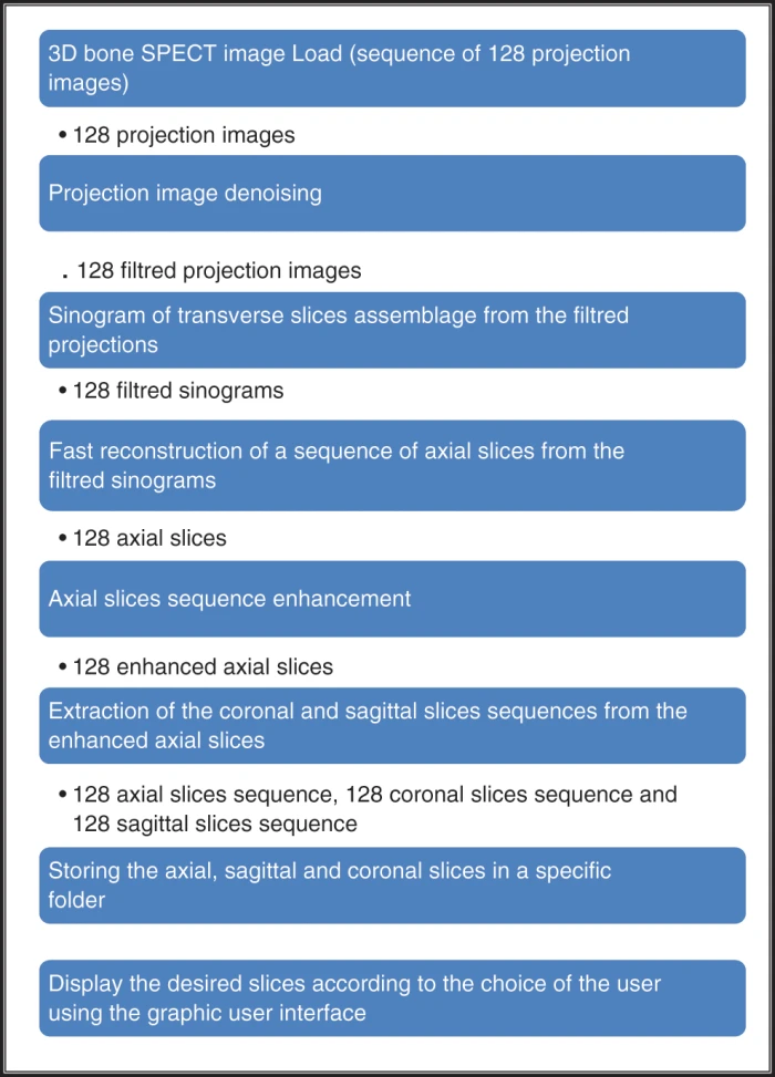 Spect Scanner Diagram