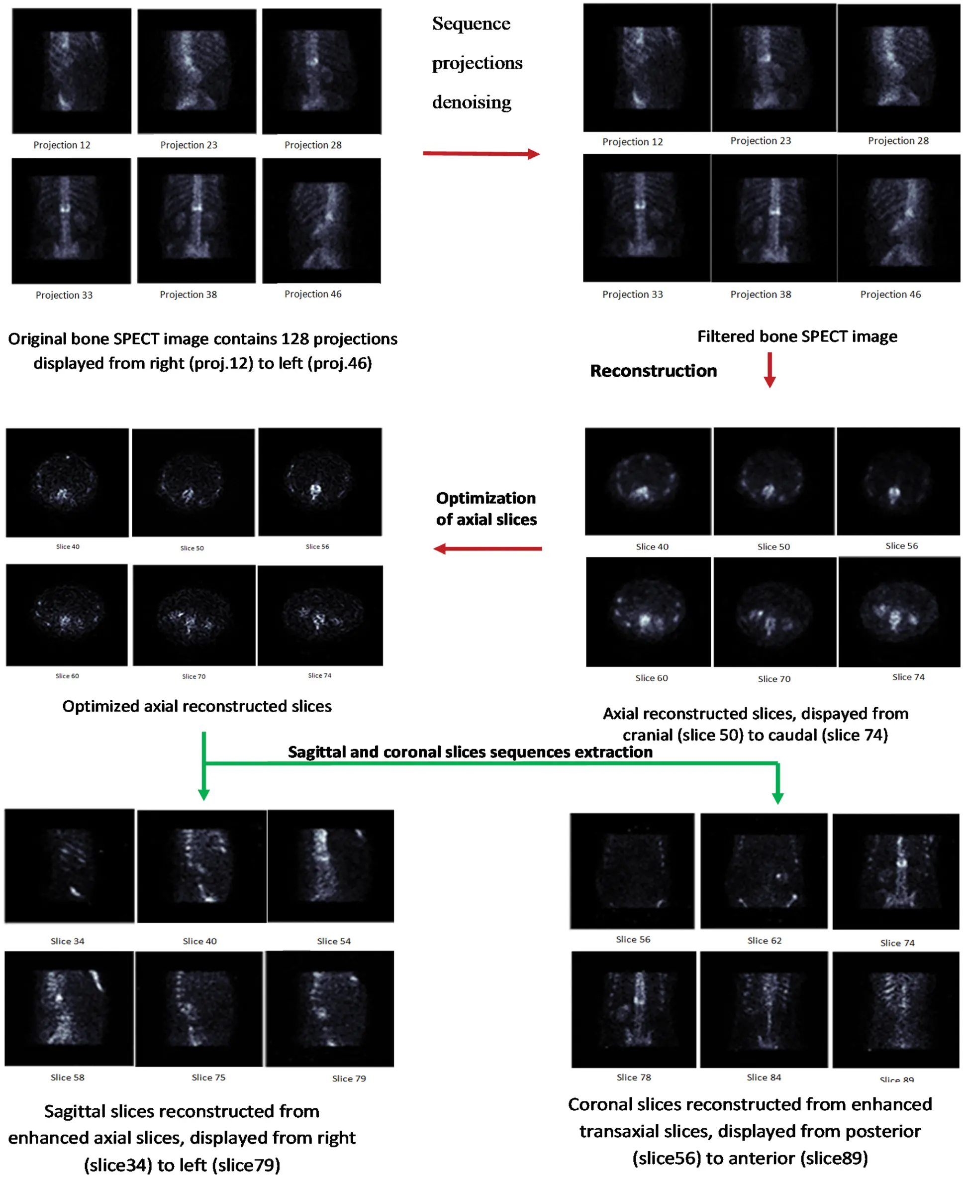 Fast and Accurate Thoracic SPECT Image Reconstruction