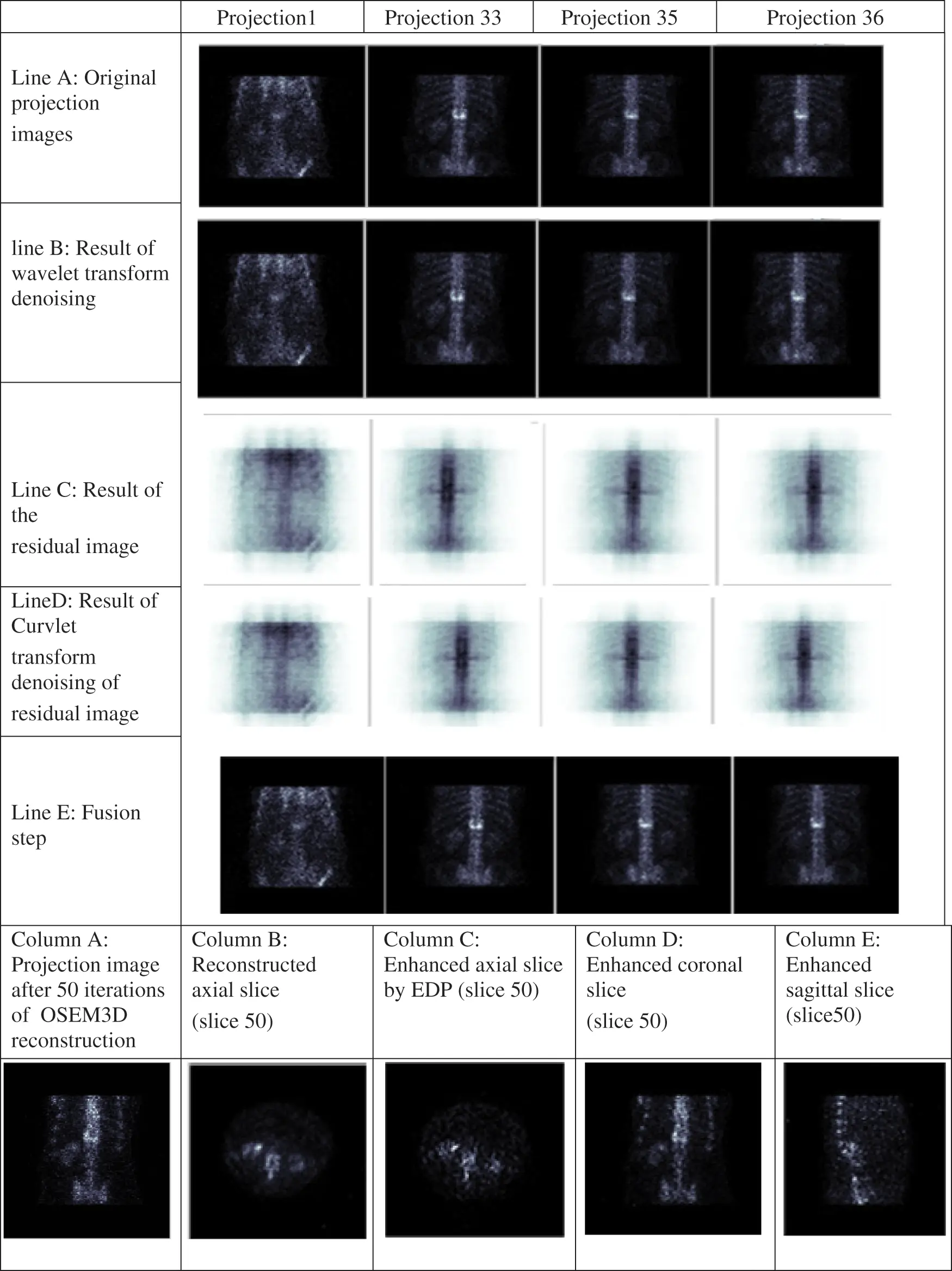 Fast and Accurate Thoracic SPECT Image Reconstruction