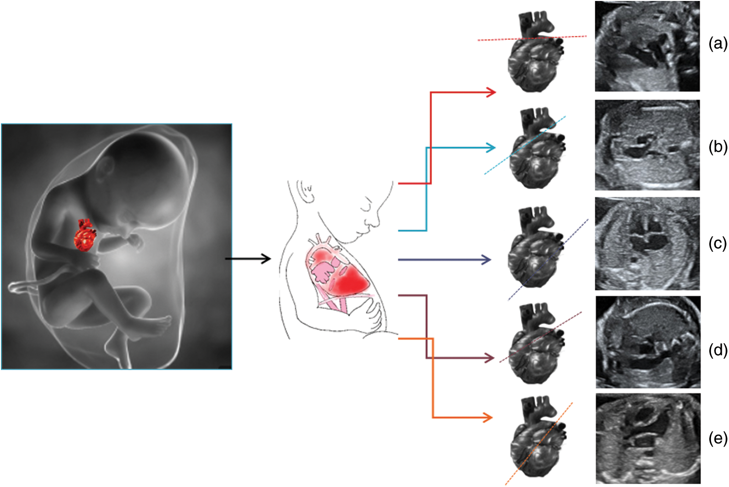 CMES | Free Full-Text | An Effective Machine-Learning Based Feature Extraction/Recognition Model ...