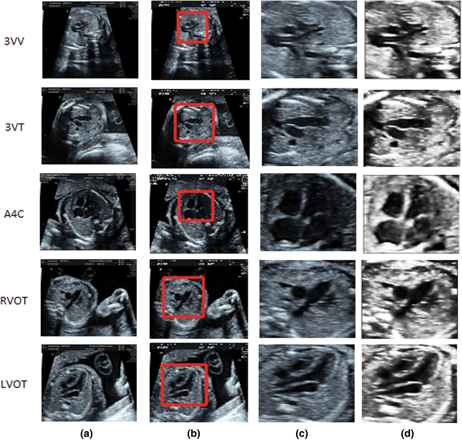 CMES | Free Full-Text | An Effective Machine-Learning Based Feature Extraction/Recognition Model ...