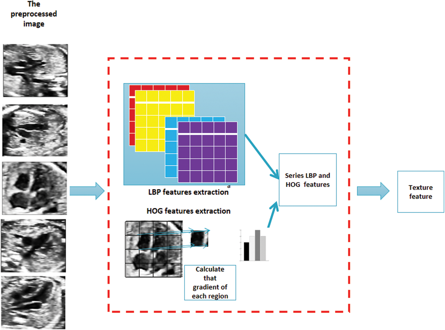 Cmes Free Full Text An Effective Machine Learning Based Feature Extraction Recognition Model