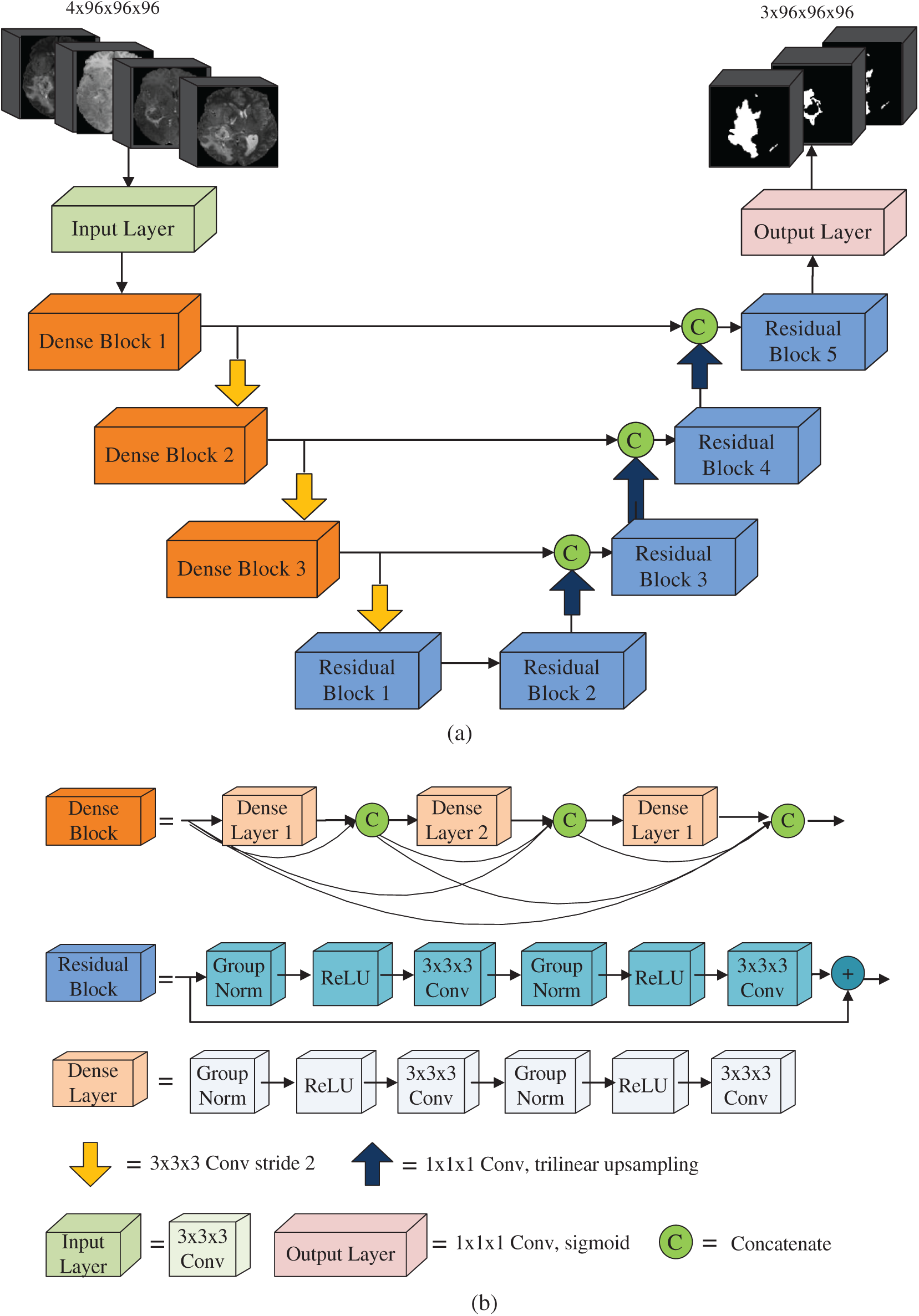 MRI Brain Tumor Segmentation Using 3D U-Net with Dense Encoder Blocks and Residual Decoder Blocks