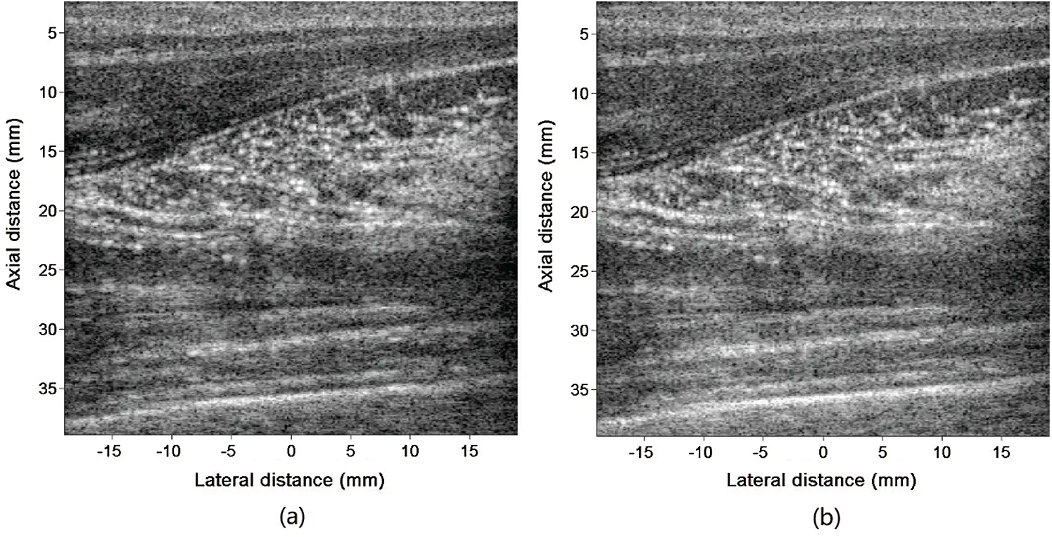 Implementing Delay Multiply and Sum Beamformer on a Hybrid CPU-GPU Platform for Medical ...