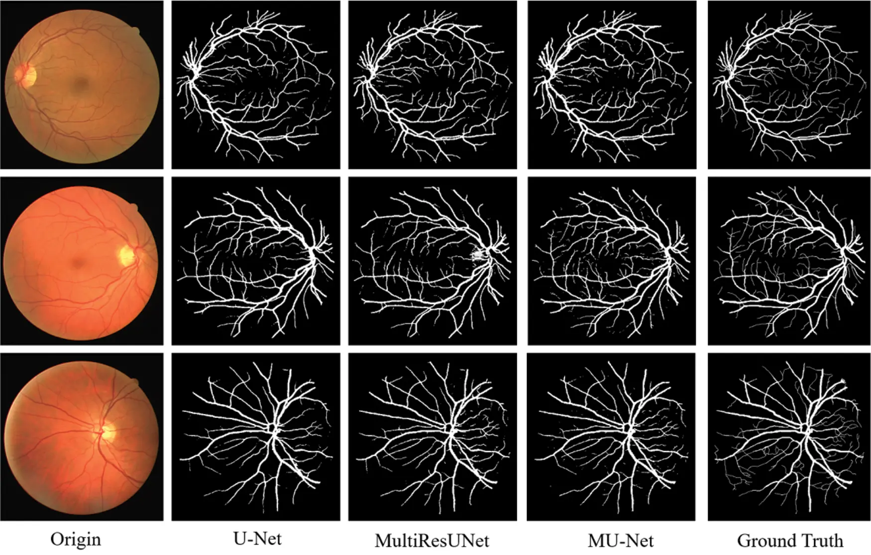 Mu-Net: Multi-Path Upsampling Convolution Network for Medical Image ...