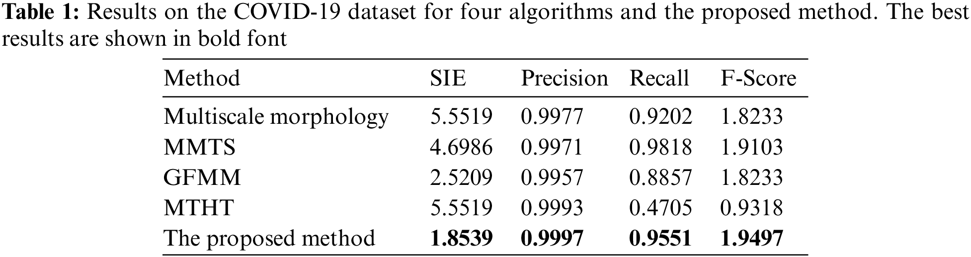 Edge Detection of COVID-19 CT Image Based on GF_SSR, Improved Multiscale Morphology, and ...
