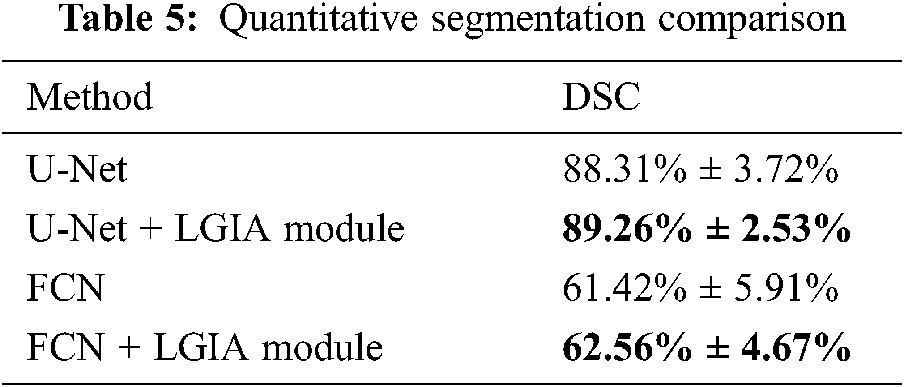 Make U Net Greater An Easy To Embed Approach To Improve Segmentation Performance Using Hypergraph
