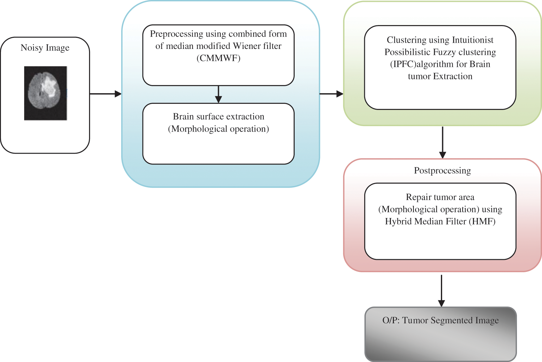 MRI Brain Tumor Segmentation with Intuitionist Possibilistic Fuzzy Clustering and Morphological ...