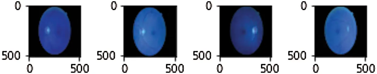 A Novel Optimizer in Deep Neural Network for Diabetic Retinopathy ...