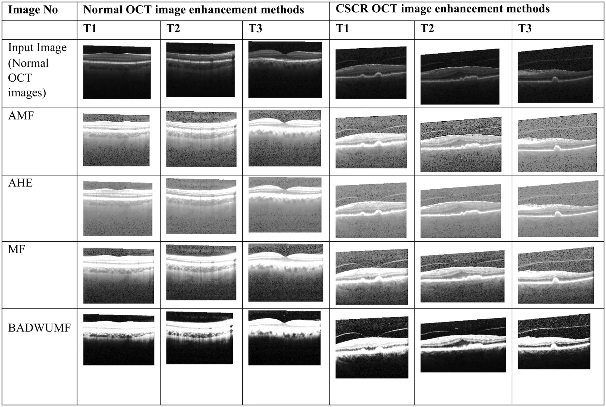 An Ophthalmic Evaluation of Central Serous Chorioretinopathy