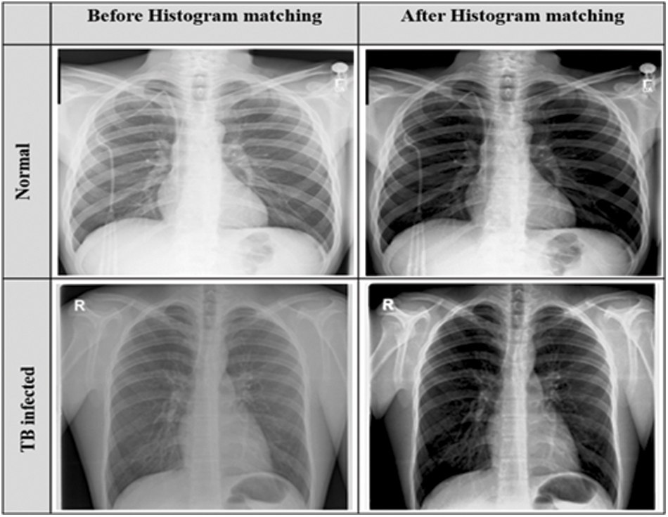 Histogram Matched Chest X-Rays Based Tuberculosis Detection Using CNN
