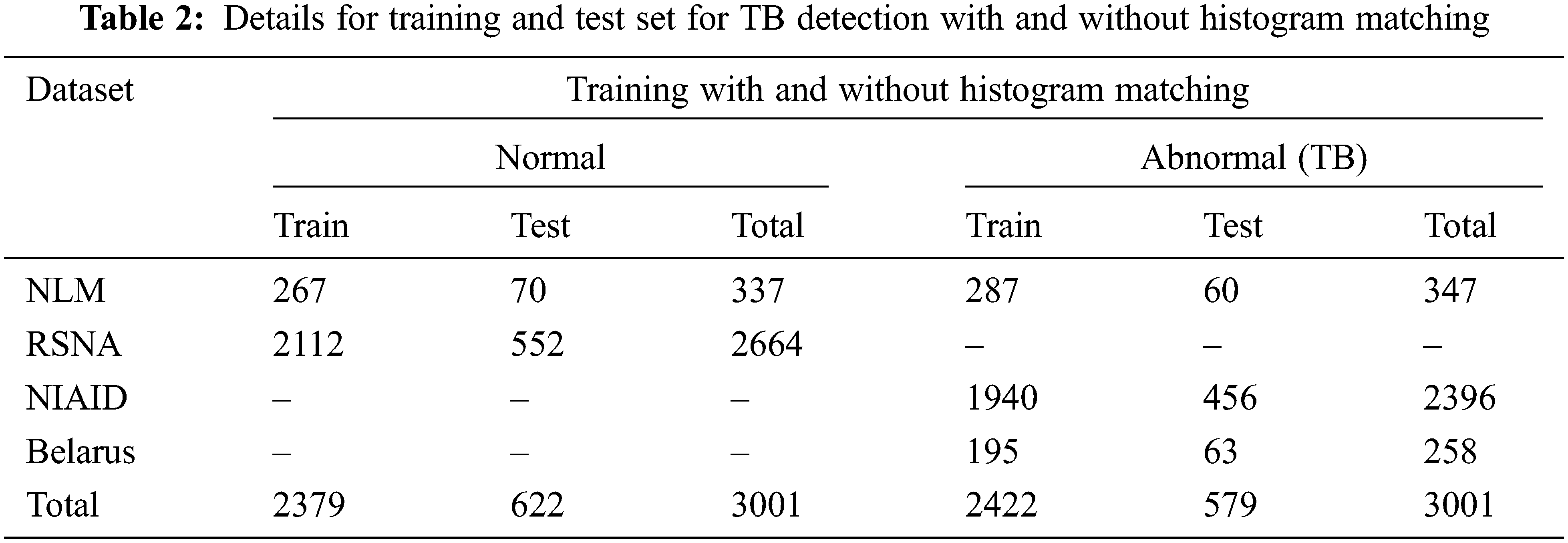 Histogram Matched Chest X-Rays Based Tuberculosis Detection Using CNN