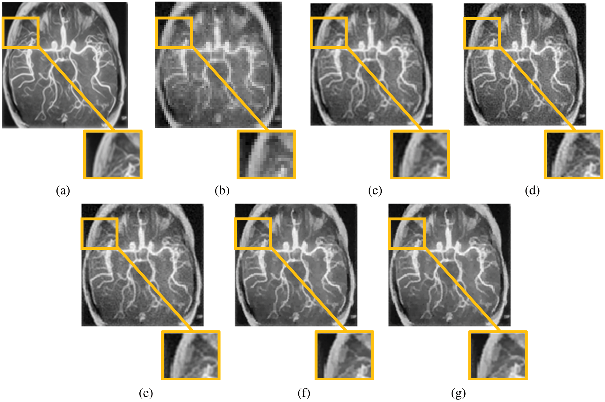A Hybrid Regularization-Based Multi-Frame Super-Resolution Using Bayesian Framework