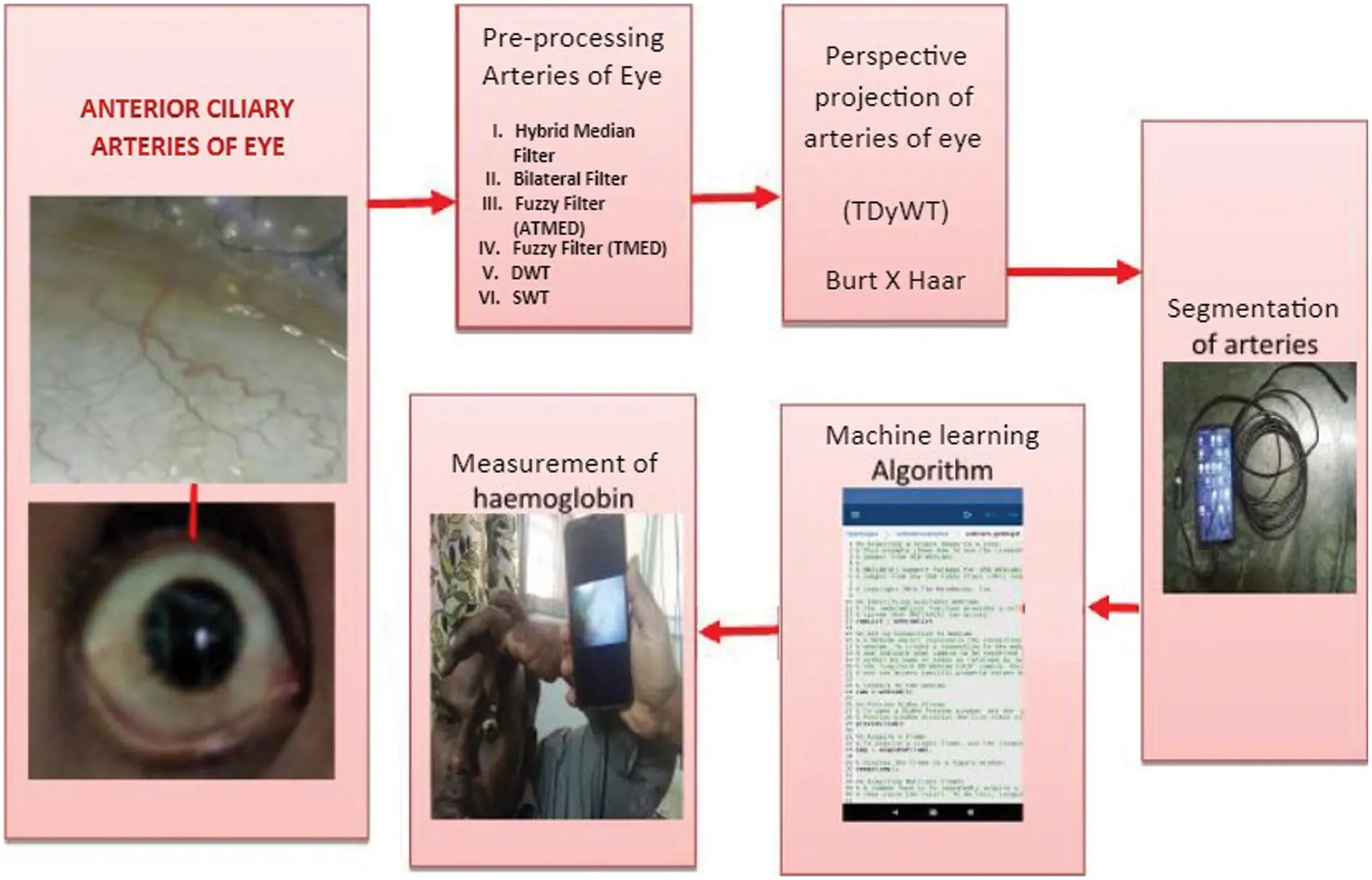Haemoglobin Measurement from Eye Anterior Ciliary Arteries through ...