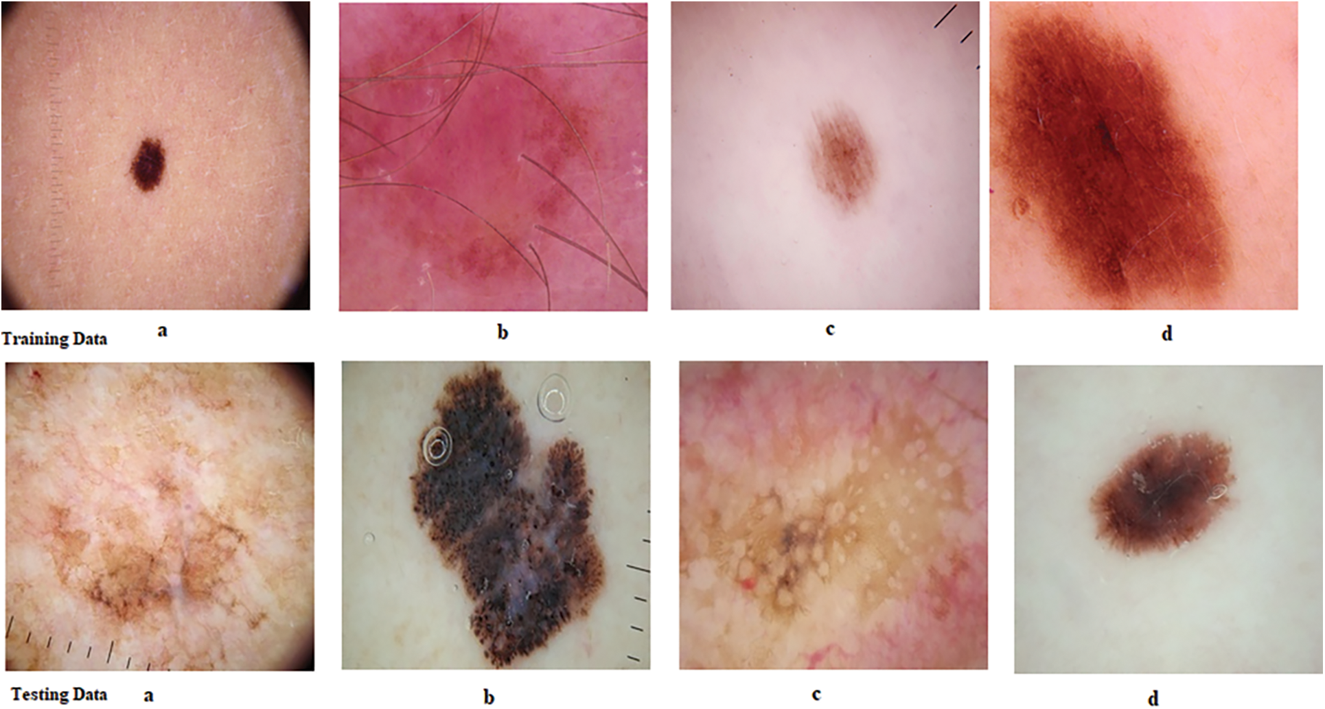 Early Skin Disease Identification Using Deep Neural Network