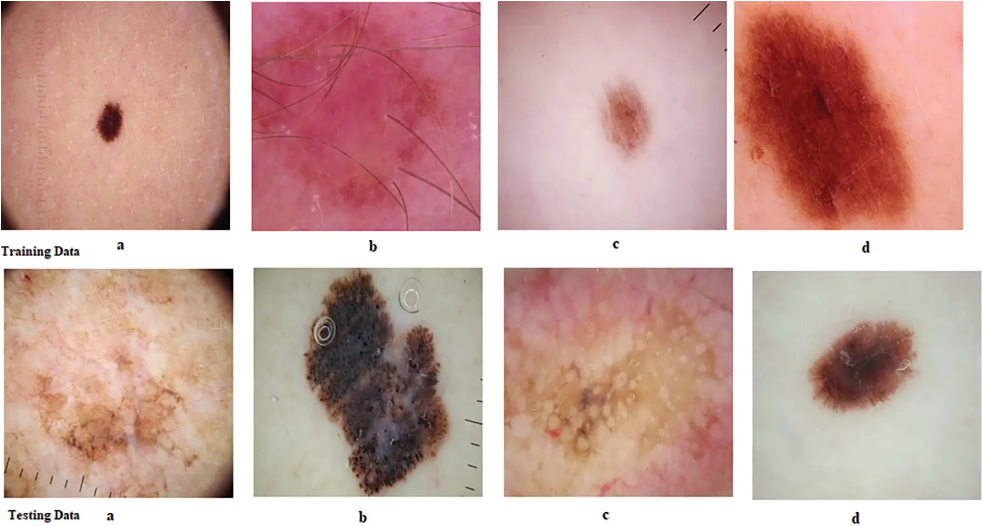 Early Skin Disease Identification Using Deep Neural Network