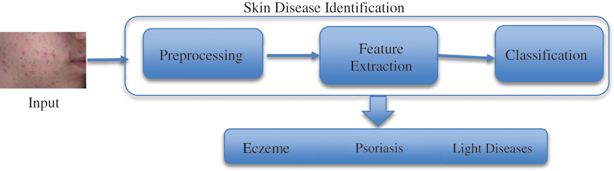 Early Skin Disease Identification Using Deep Neural Network
