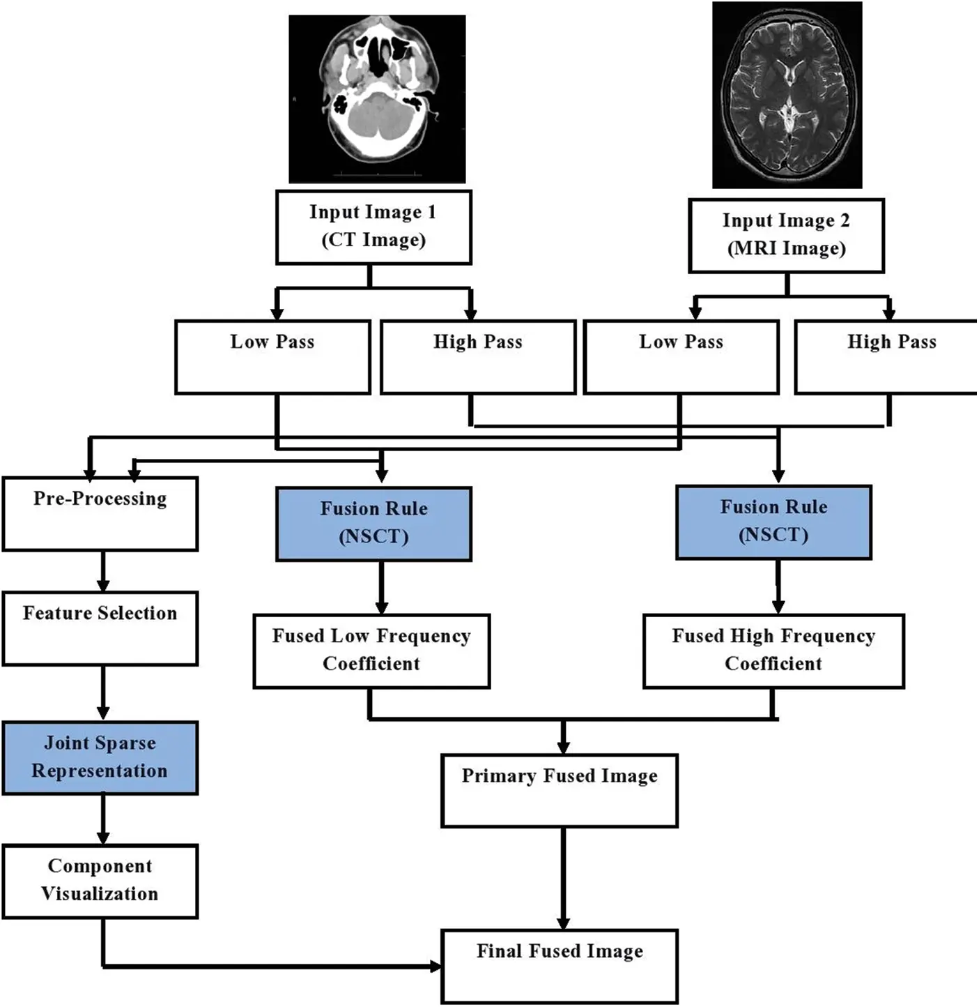 Non Sub-Sampled Contourlet with Joint Sparse Representation Based ...