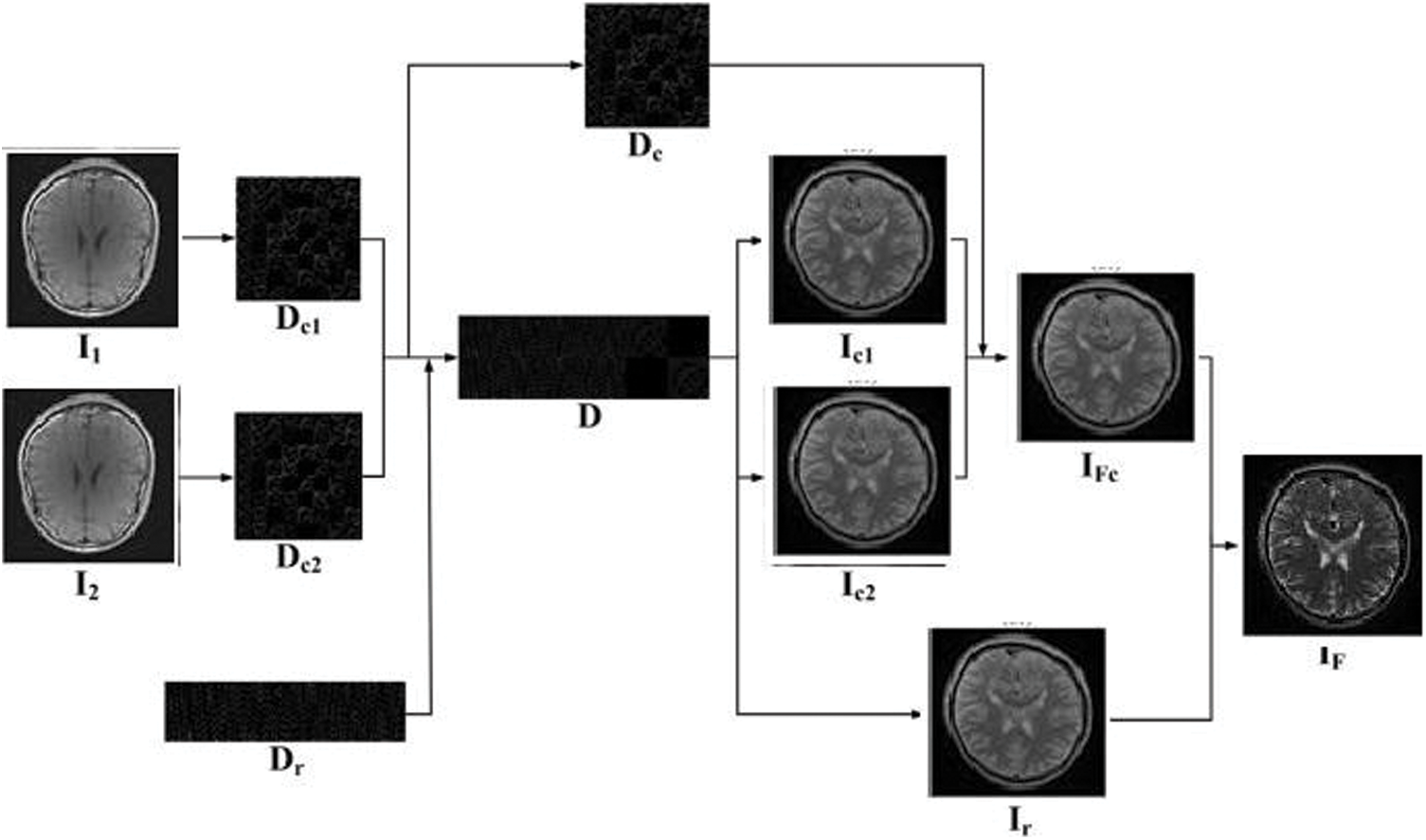 Non Sub-Sampled Contourlet with Joint Sparse Representation Based Medical Image Fusion