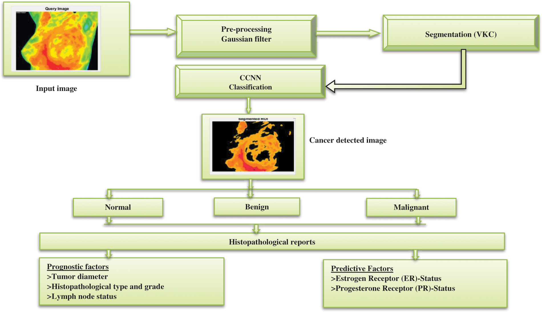 CSSE | Free Full-Text | Micro Calcification Detection in Mammogram Images Using Contiguous ...