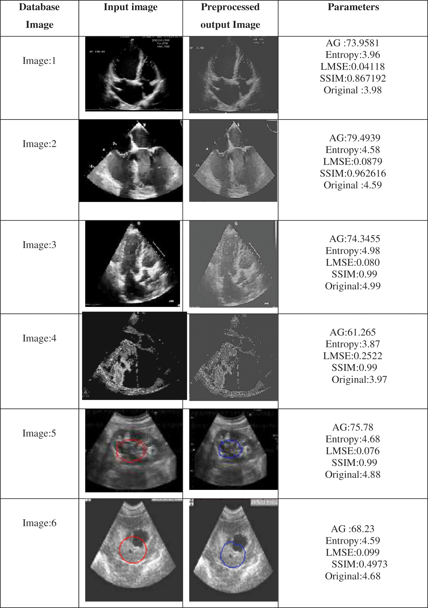 CSSE | Free Full-Text | Image Enhancement Using Adaptive Fractional Order Filter