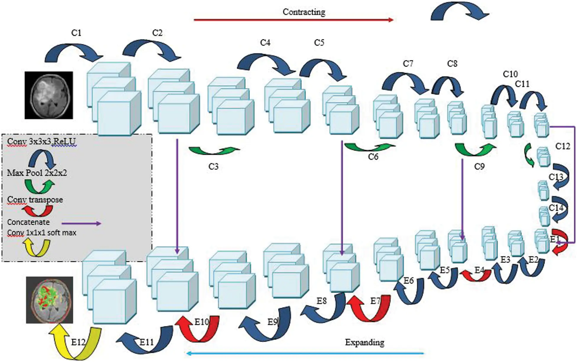 CSSE | Free Full-Text | Brain Tumor: Hybrid Feature Extraction Based on UNet and 3DCNN