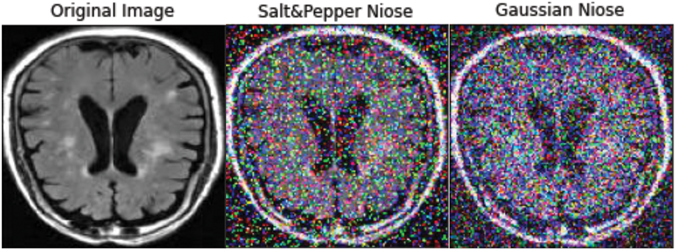 CSSE | Free Full-Text | De-Noising Brain MRI Images by Mixing ...