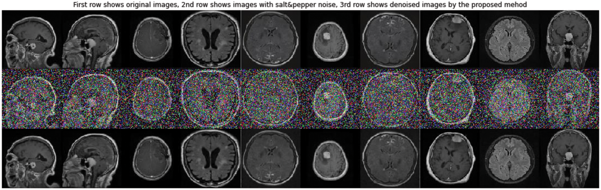 CSSE | Free Full-Text | De-Noising Brain MRI Images by Mixing ...