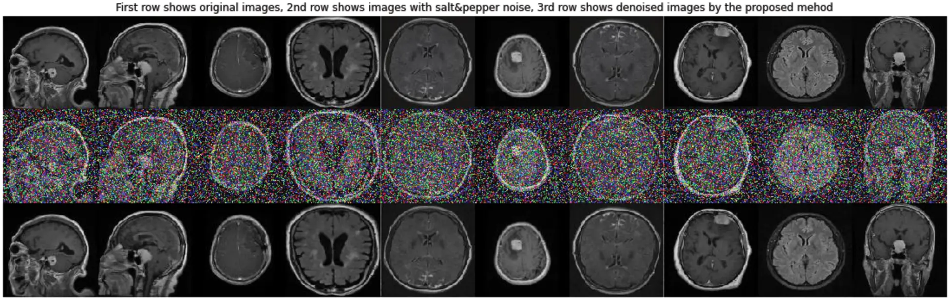 CSSE | Free Full-Text | De-Noising Brain MRI Images by Mixing ...
