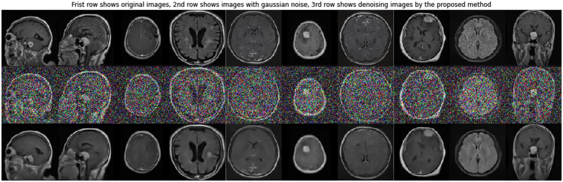 CSSE | Free Full-Text | De-Noising Brain MRI Images by Mixing Concatenation and Residual ...