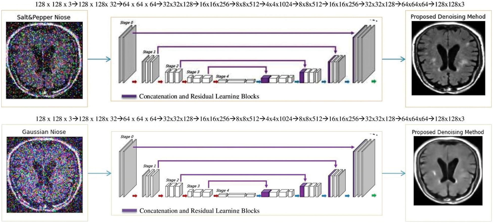 CSSE | Free Full-Text | De-Noising Brain MRI Images by Mixing ...