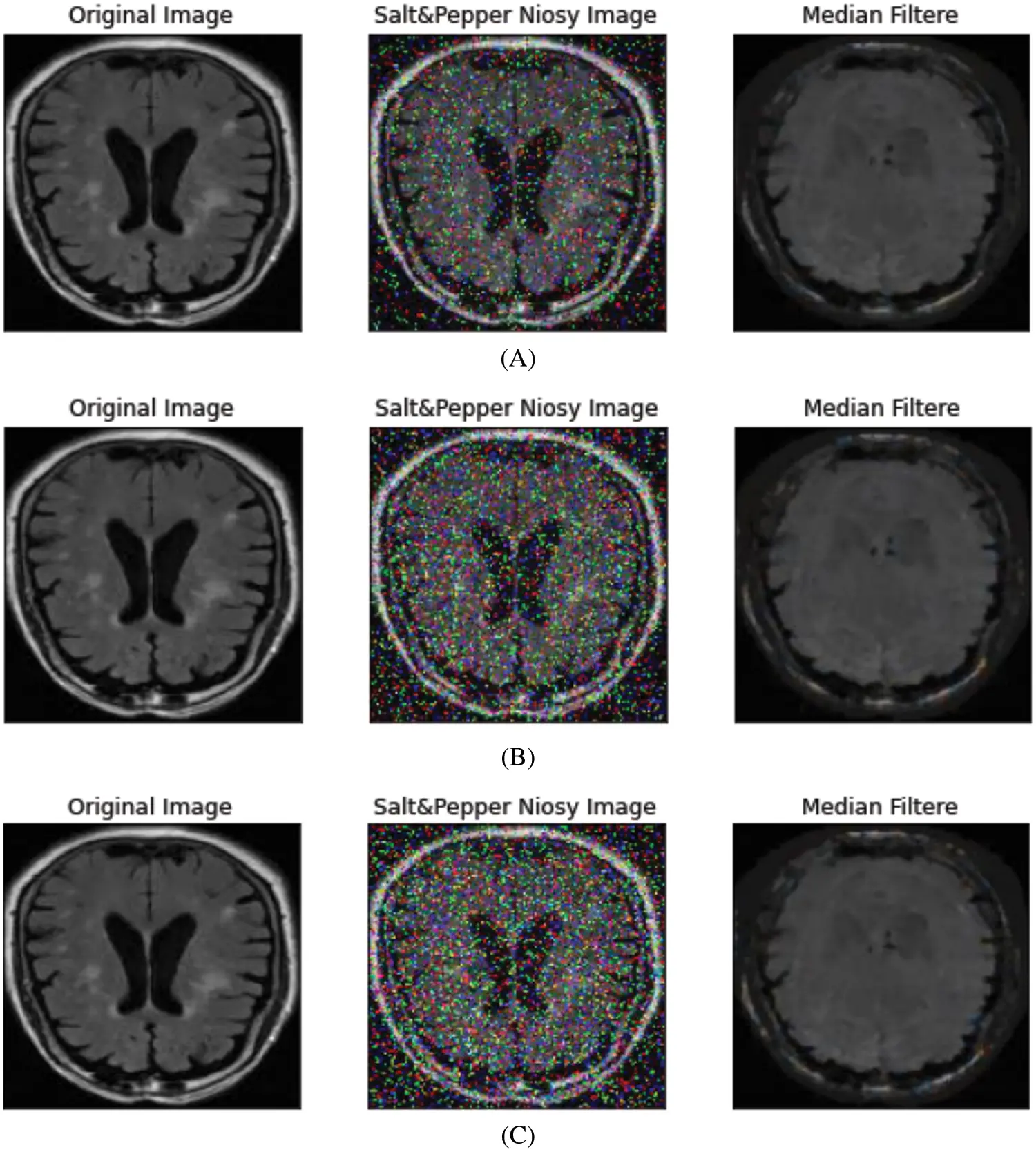 CSSE | Free Full-Text | De-Noising Brain MRI Images by Mixing ...