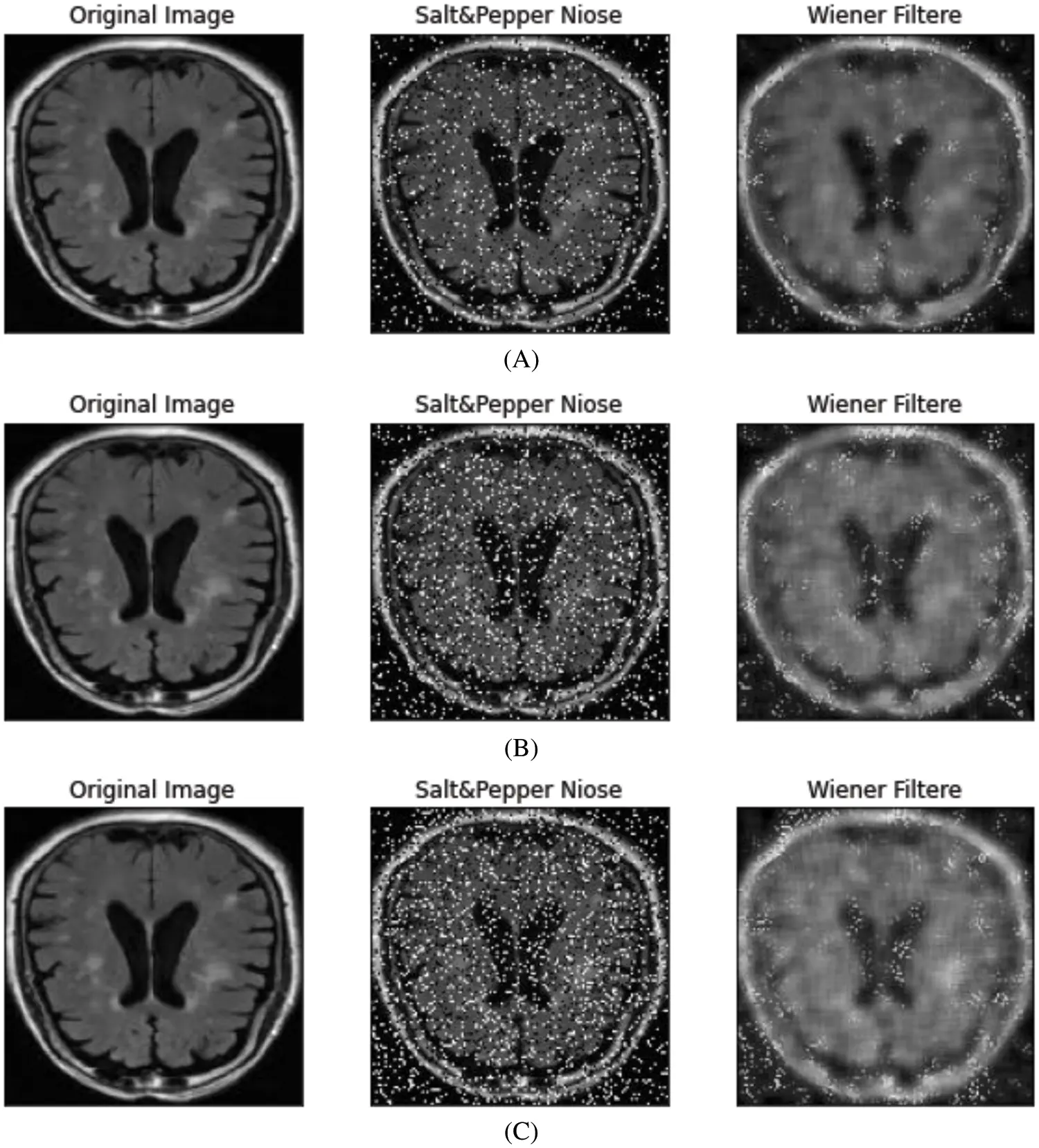 CSSE | Free Full-Text | De-Noising Brain MRI Images by Mixing ...