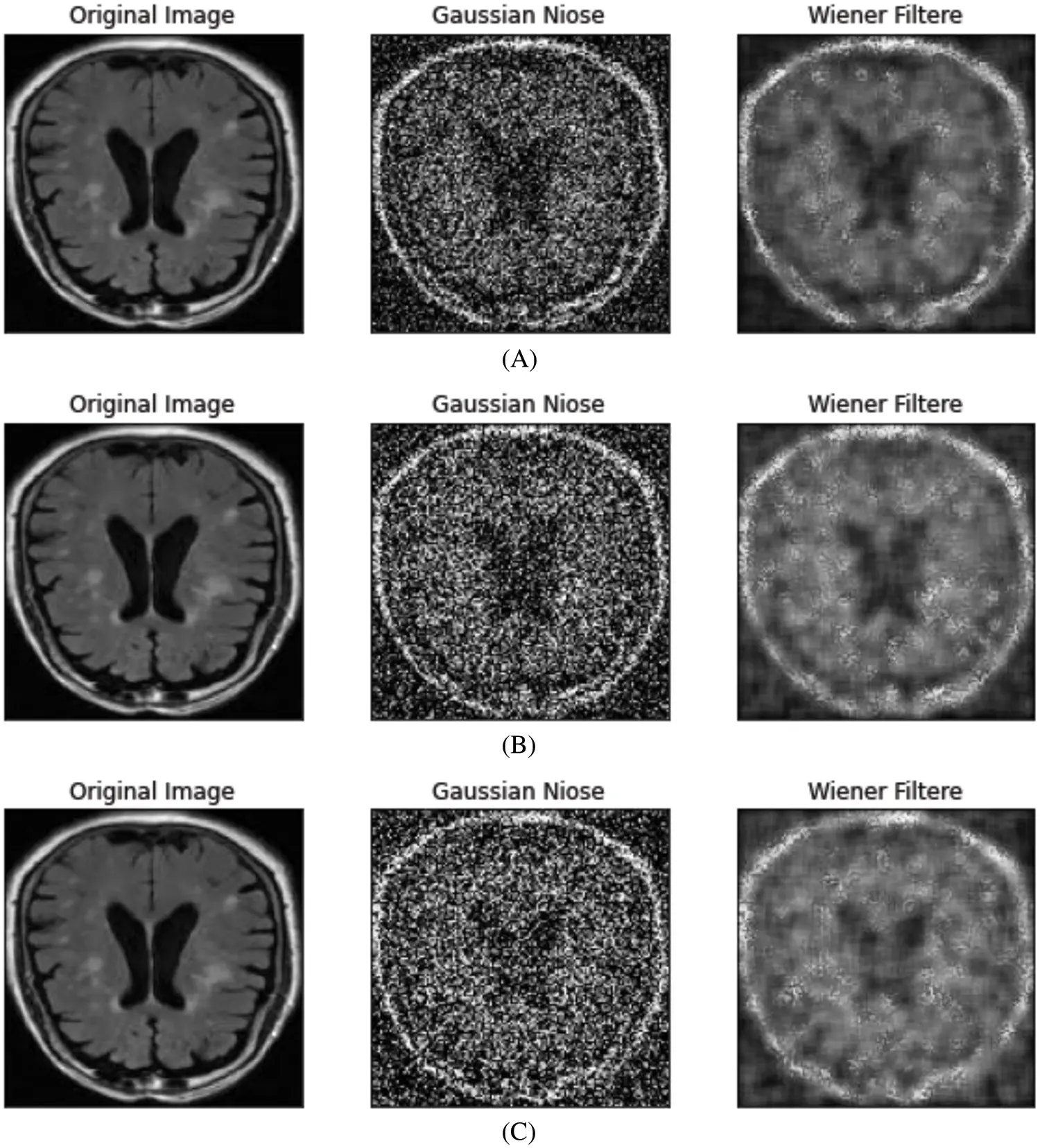 CSSE | Free Full-Text | De-Noising Brain MRI Images by Mixing ...