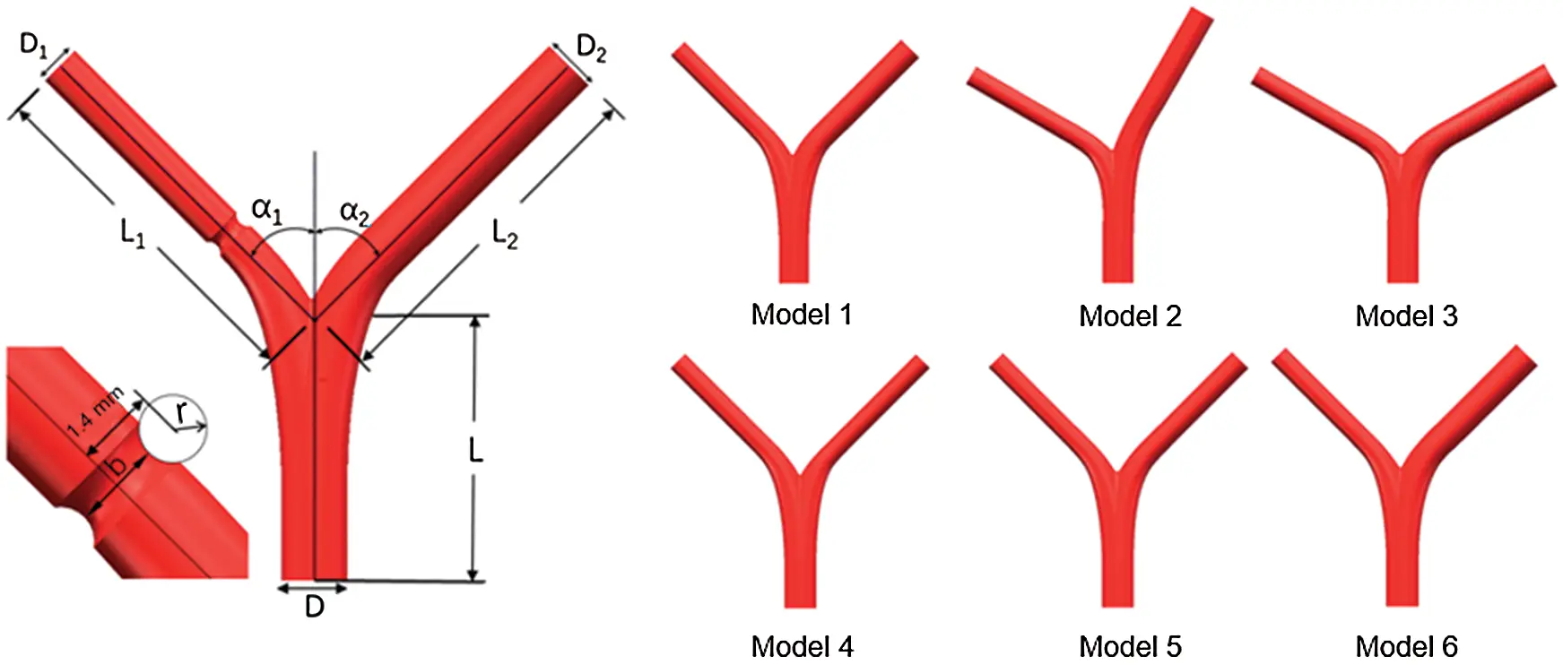 A Computational Study on the Effect of Bifurcation Lesions with ...