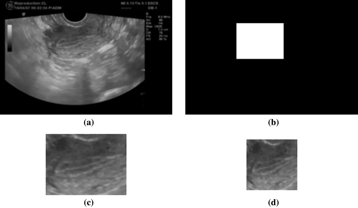 A Pregnancy Prediction System based on Uterine Peristalsis from ...