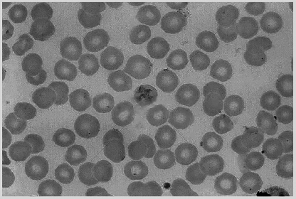 A Morphological Image Segmentation Algorithm for Circular Overlapping Cells