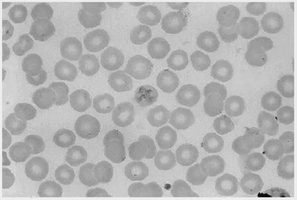 A Morphological Image Segmentation Algorithm for Circular Overlapping Cells