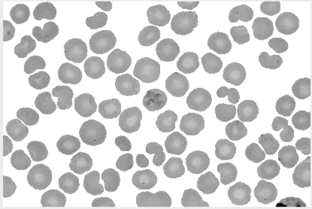 A Morphological Image Segmentation Algorithm for Circular Overlapping Cells