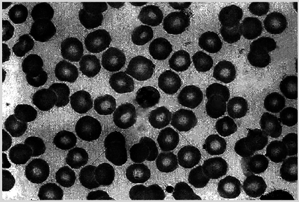 A Morphological Image Segmentation Algorithm for Circular Overlapping Cells