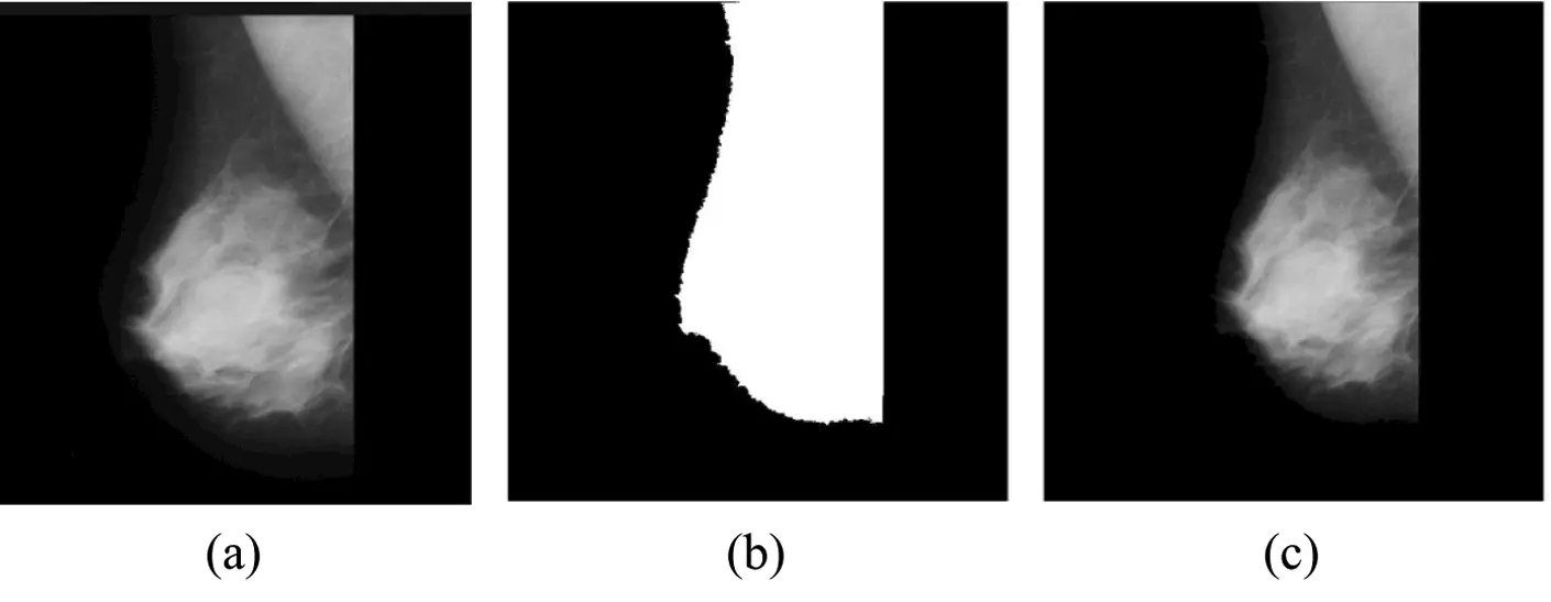 Breast Cancer Detection and Classification Using Deep CNN Techniques