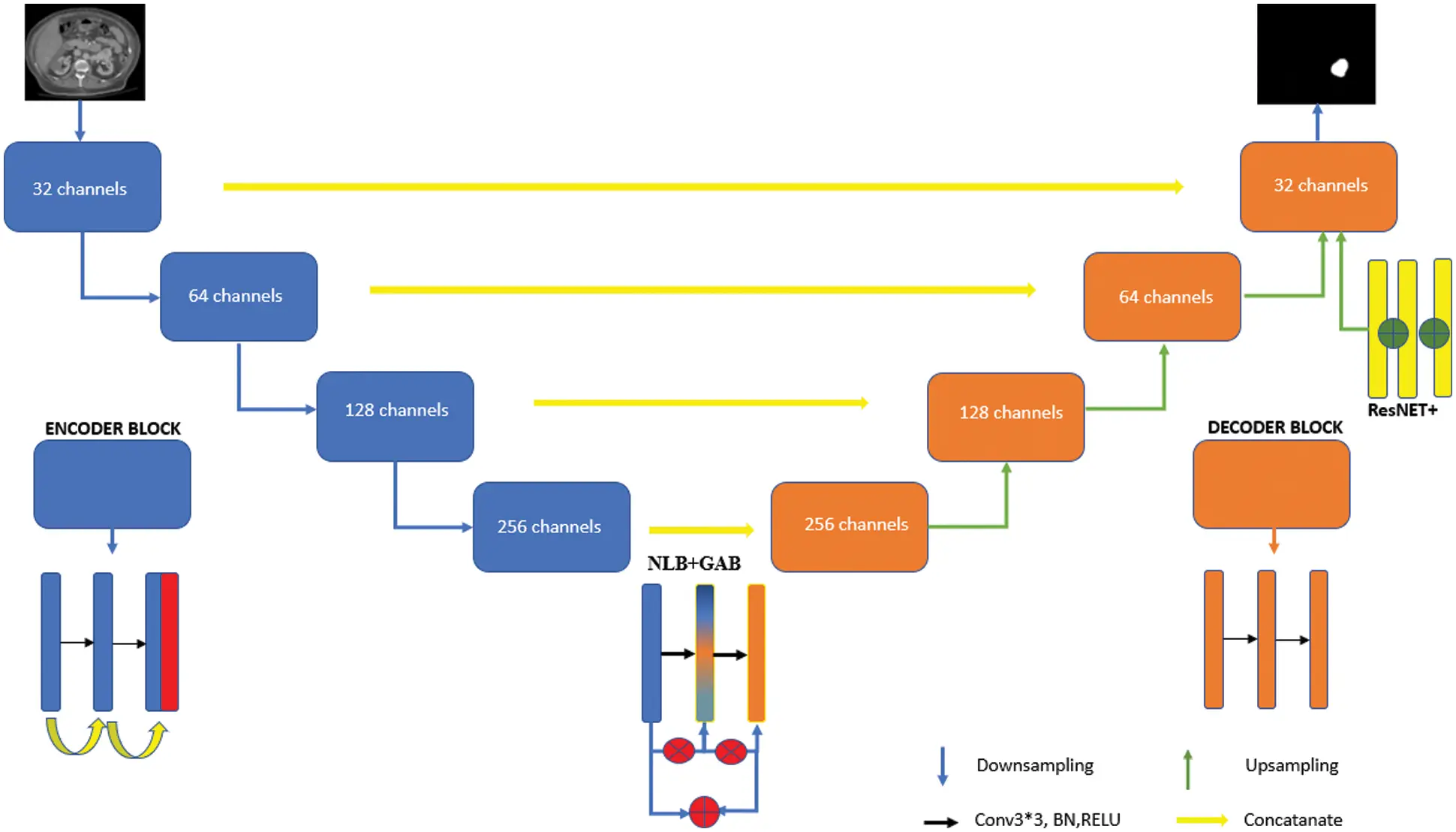 Kidney Tumor Segmentation Using Two-Stage Bottleneck Block Architecture